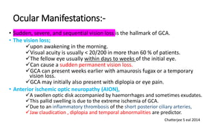 Gaint cell arteritiis (GCA) | PPTX