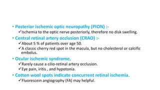 Gaint cell arteritiis (GCA) | PPTX