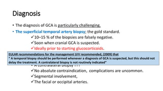 Gaint cell arteritiis (GCA) | PPTX