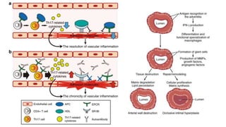 Gaint cell arteritiis (GCA) | PPTX