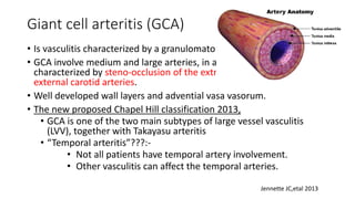 Gaint cell arteritiis (GCA) | PPT