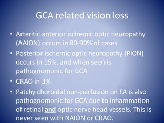 Review of Giant Cell Arteritis | PPTX
