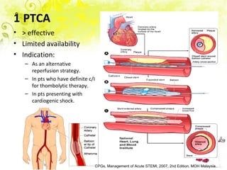 case scenario 1-chest pain | PPT
