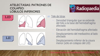 Signos radiograficos en el torax del adulto | PPTX