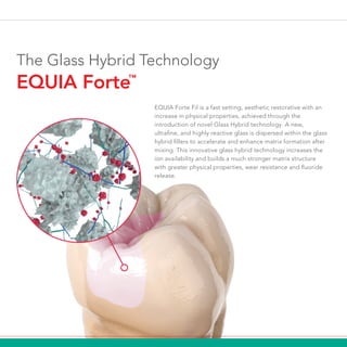GC EQUIA Forte Fil Bulk Fill Capsule From GC India Dental. | PDF