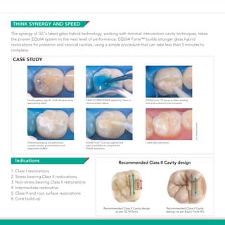 GC EQUIA Forte Fil Bulk Fill Capsule From GC India Dental. | PDF