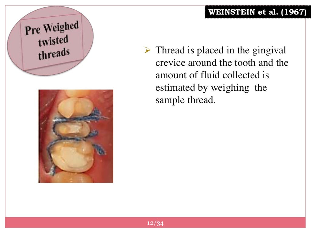 Gingival crevicular fluid