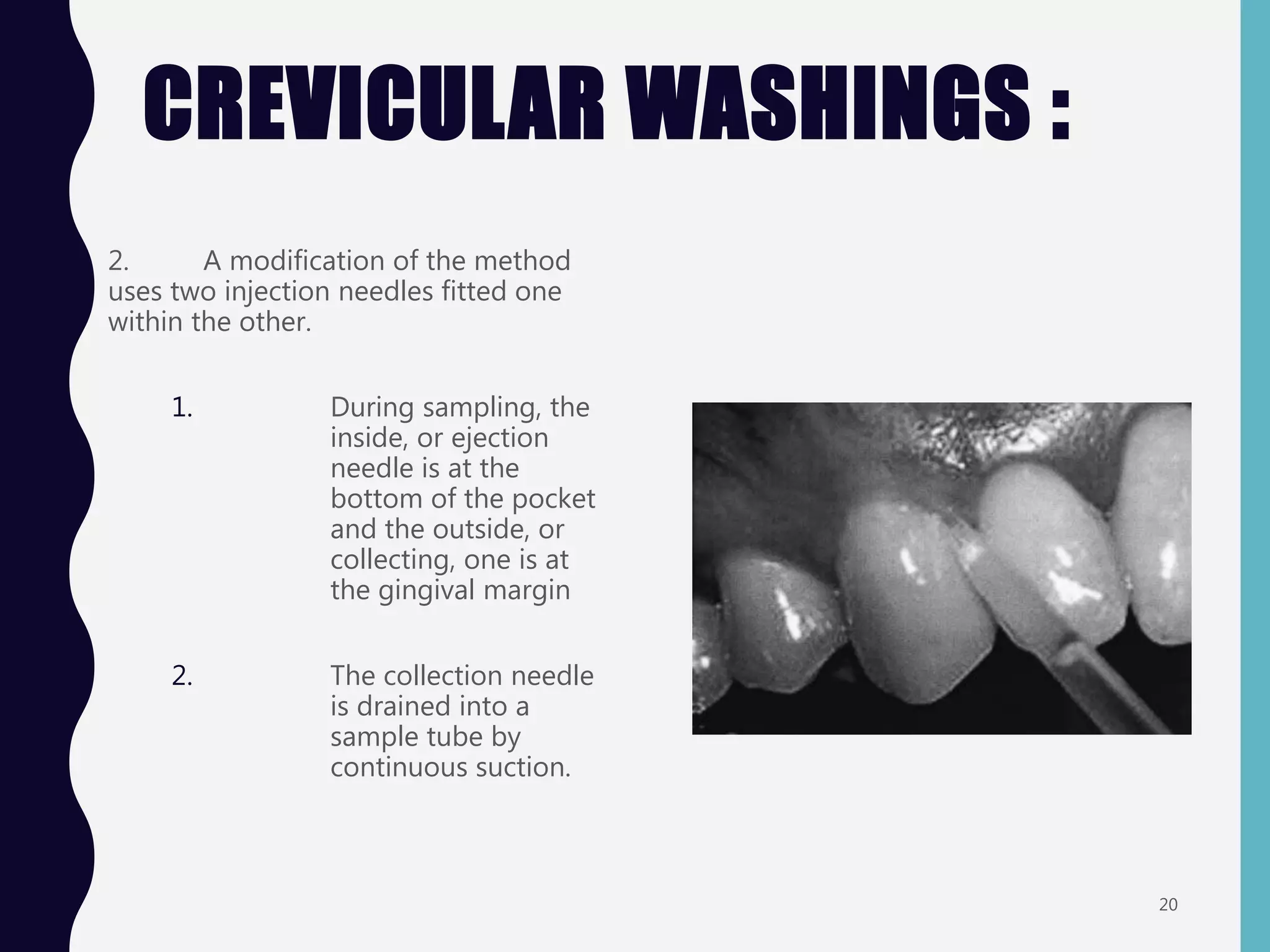 Gingival crevicular Fluid | PPTX | Dental Health | Diseases and Conditions
