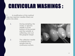 Gingival crevicular Fluid | PPTX