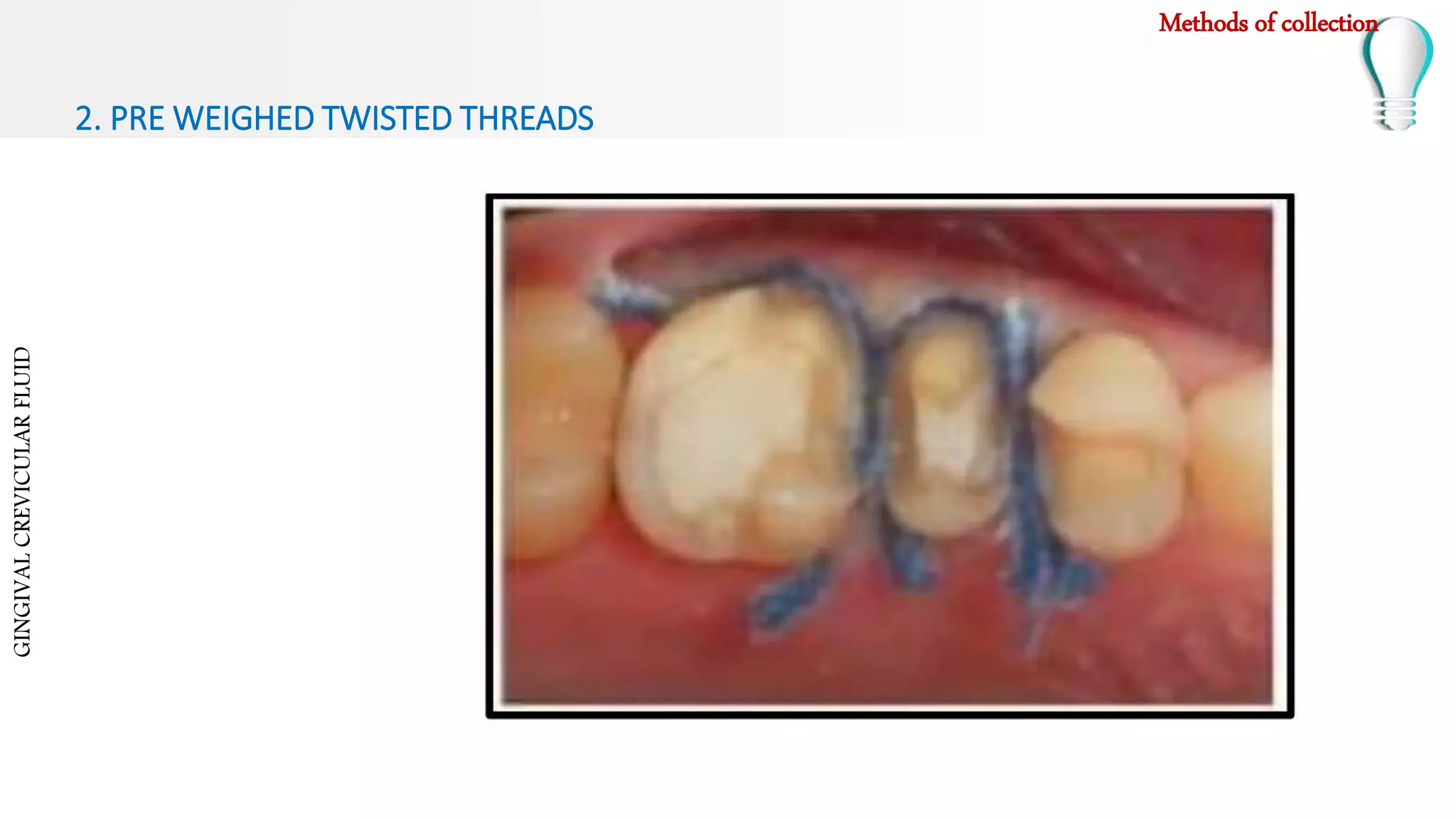 Gingival Crevicular Fluid (GCF/ Sulcular Fluid) | PPTX