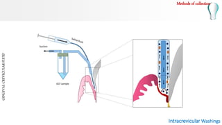 Gingival Crevicular Fluid (GCF/ Sulcular Fluid) | PPTX