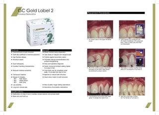 Gc Gold Label 9 Posterior Restorative - Gc India Dental | PPT