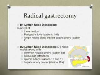 Gastric cancer Treatment | PPT