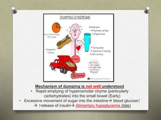 Gastric cancer Treatment | PPTX