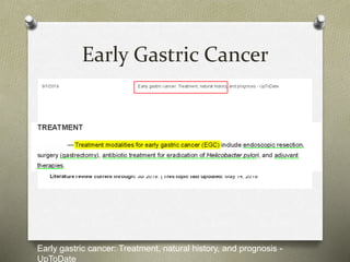 Gastric cancer Treatment | PPT