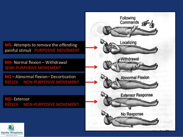 GCS - The fundamentals for nurses and nursing students