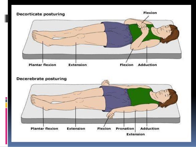 Modified Glasgow Coma Scale for Infants and Children – DR. TRYNAADH