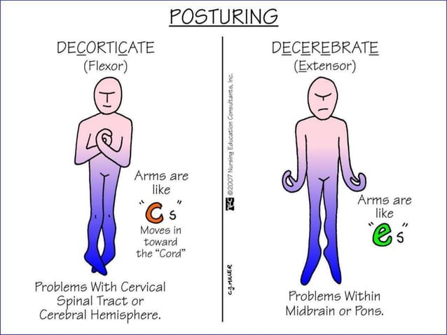 Gcs( GLASGOW COMA SCALE) | PPTX | Death, Injury, or Military Conflict ...