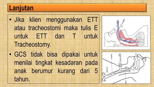 GCS Tingkat Kesadaran | PPTX
