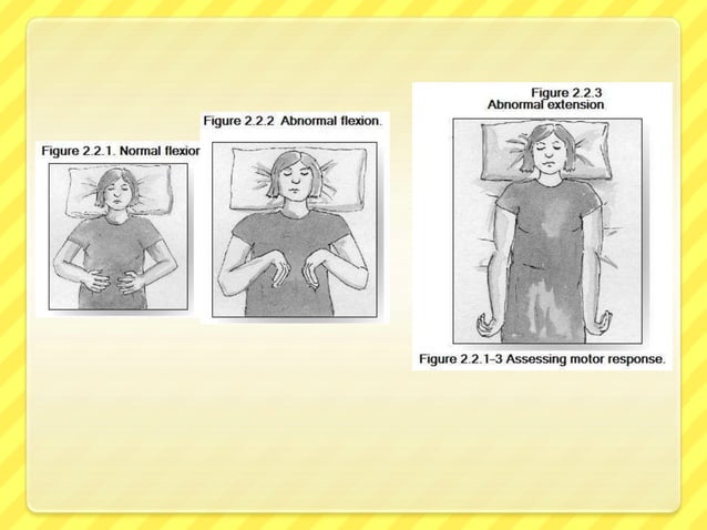 gcs(Glasgow Coma Scale) ppt to understand.pptx | First Aid | Injuries
