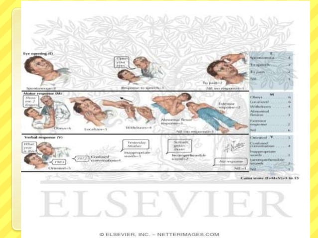 gcs(Glasgow Coma Scale) ppt to understand.pptx | First Aid | Injuries