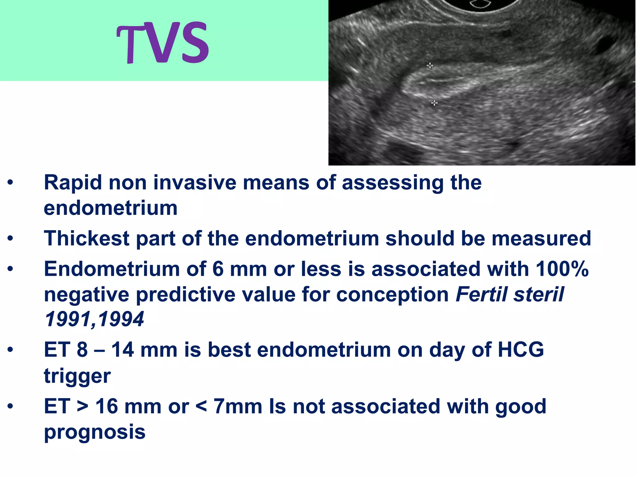 Thin Endometrium Granulocyte Colony Stimulating Factor (GCSF)- What ...