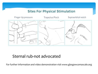 The Glasgow Coma Scale (GCS) | PPTX