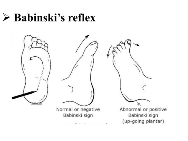 GLASSGOW COMA SCALE & REFLEXES | PPTX