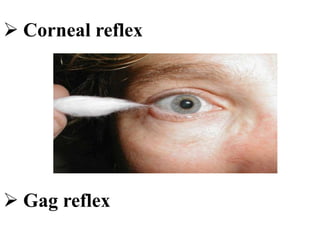 GLASSGOW COMA SCALE & REFLEXES | PPTX