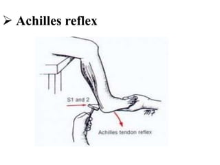 Achilles Reflex Diagram