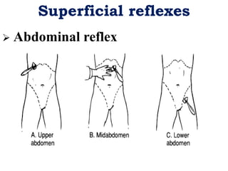 Superficial Abdominal Reflex