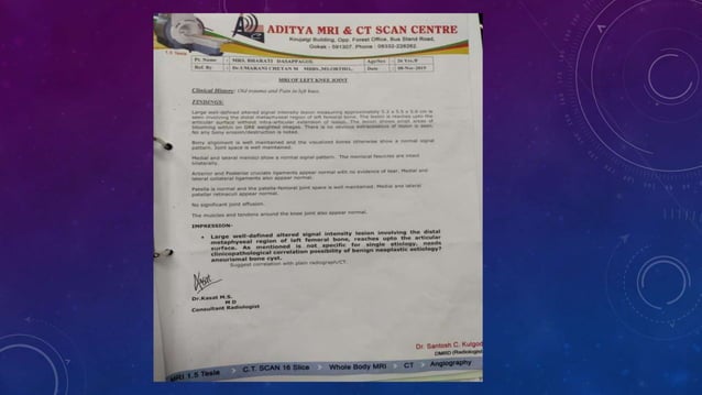 Gct of distal femur | PPT