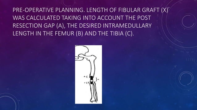 Gct of distal femur | PPT