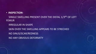 Gct of distal femur | PPTX