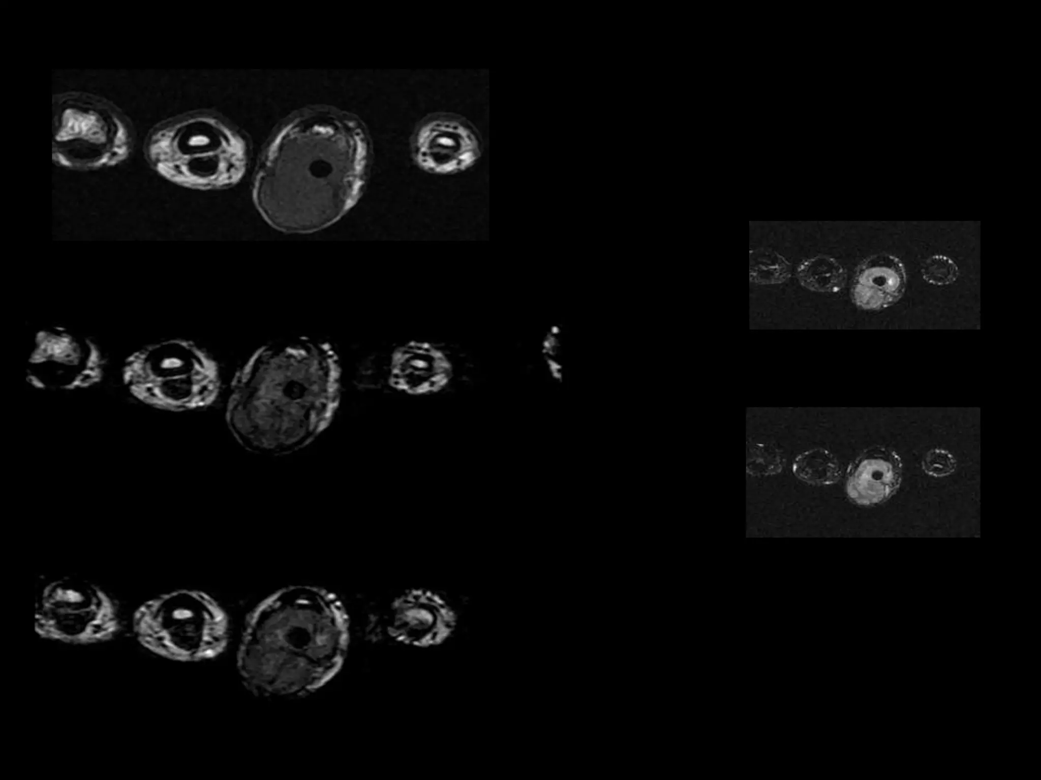 Gct tendon sheath mercury imaging | PPTX