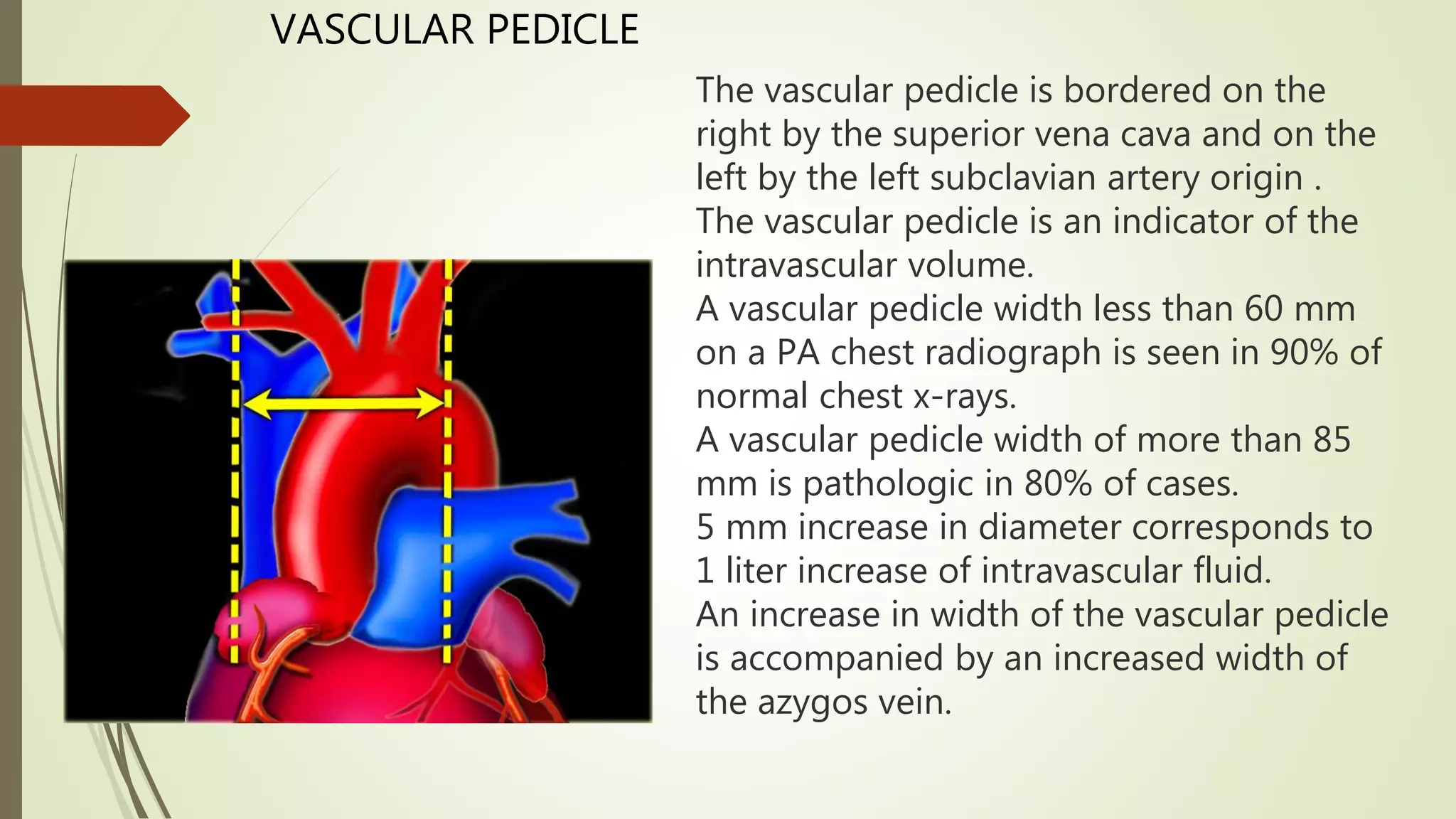 chest xray of cardiovascular disease PPT | PPTX