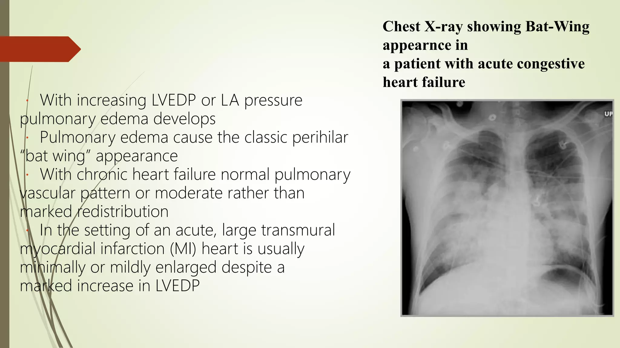 chest xray of cardiovascular disease PPT | PPTX