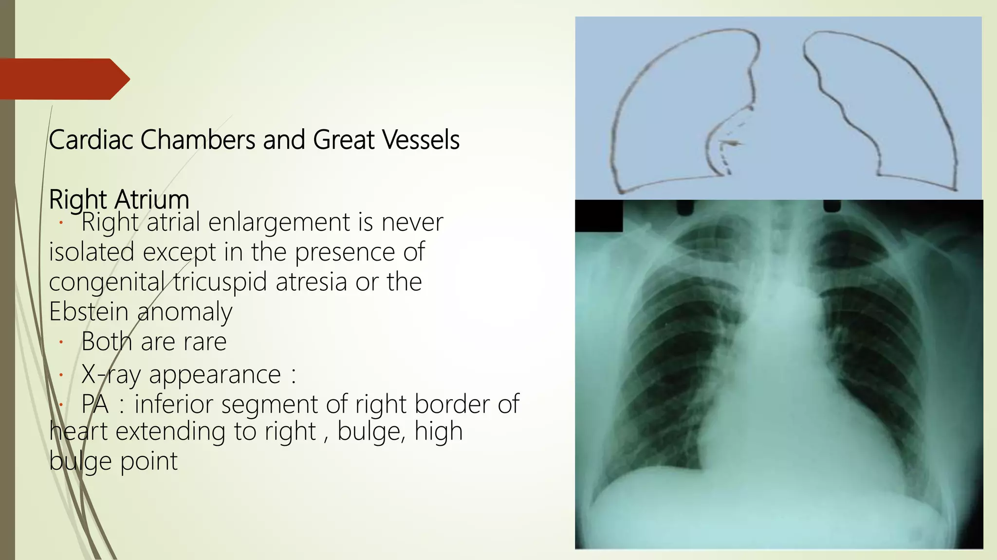 chest xray of cardiovascular disease PPT | PPTX