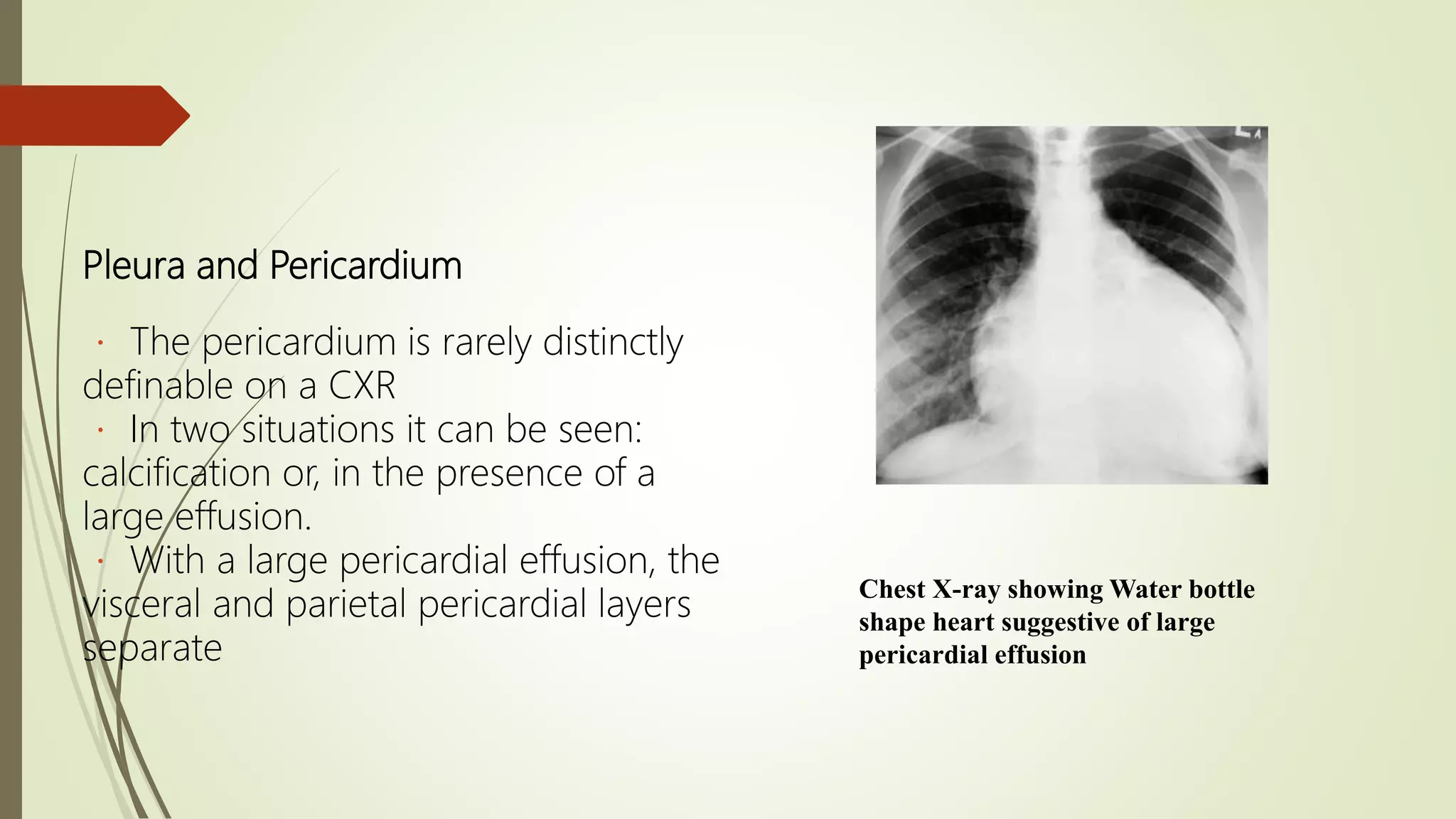 chest xray of cardiovascular disease PPT | PPTX