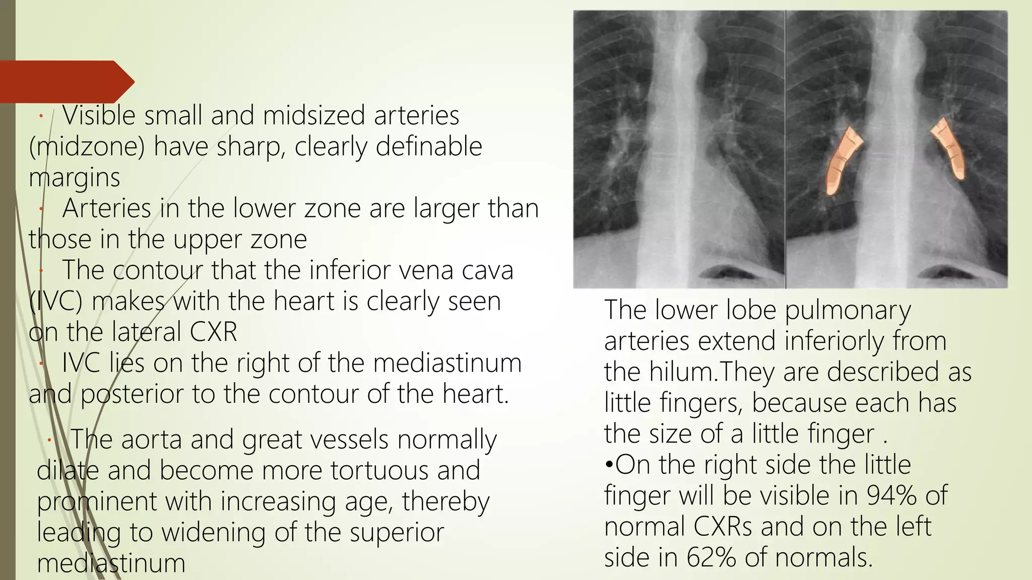 chest xray of cardiovascular disease PPT | PPTX