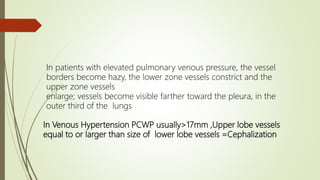 chest xray of cardiovascular disease PPT | PPTX