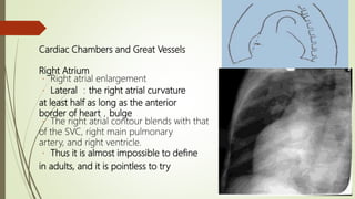 chest xray of cardiovascular disease PPT | PPTX