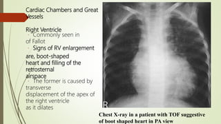 chest xray of cardiovascular disease PPT | PPTX