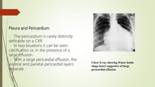 chest xray of cardiovascular disease PPT | PPTX