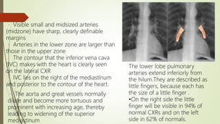chest xray of cardiovascular disease PPT | PPTX