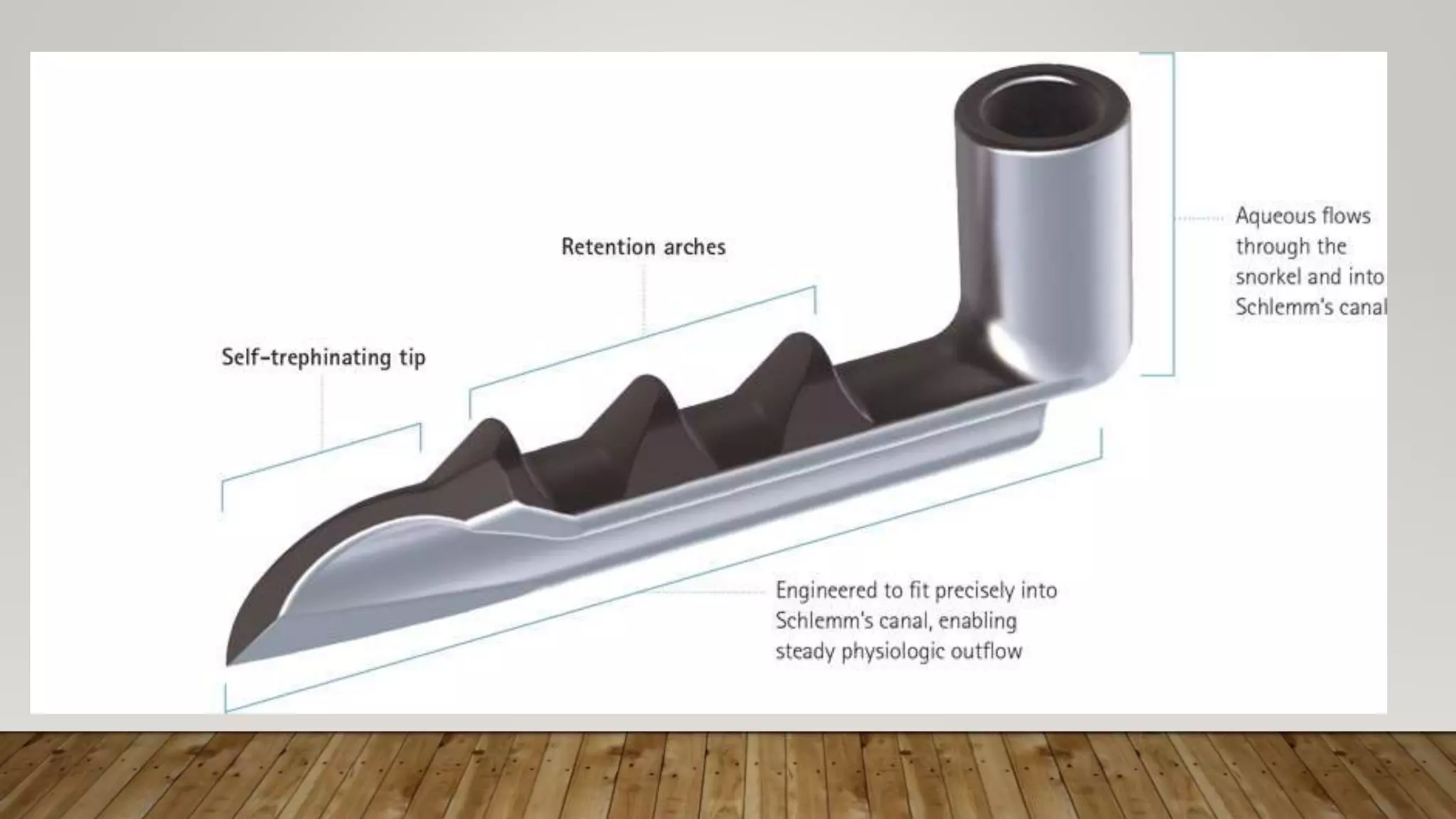 Glaucoma drainage devices | PPTX