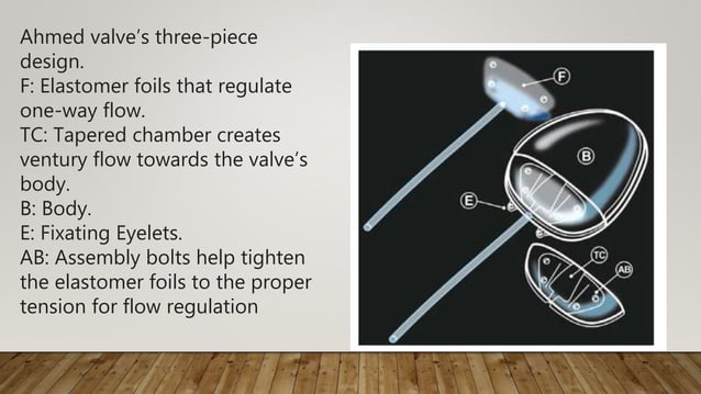 Glaucoma drainage devices | PPTX