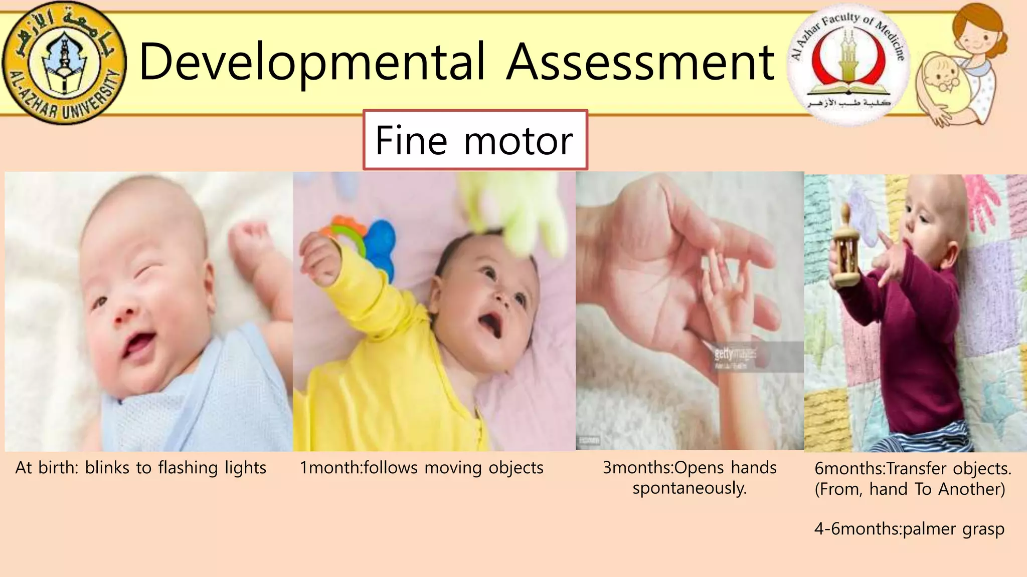 Global Developmental Delay (GDD) | PPTX