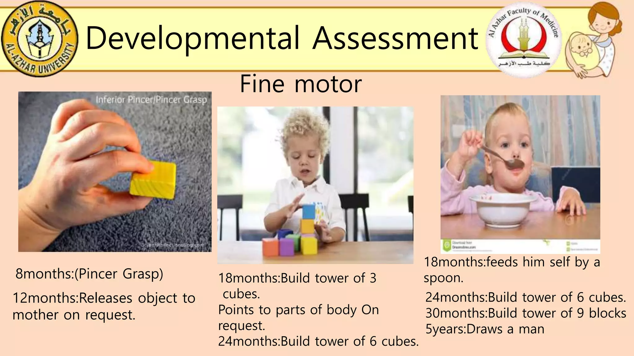 Global Developmental Delay (GDD) | PPTX