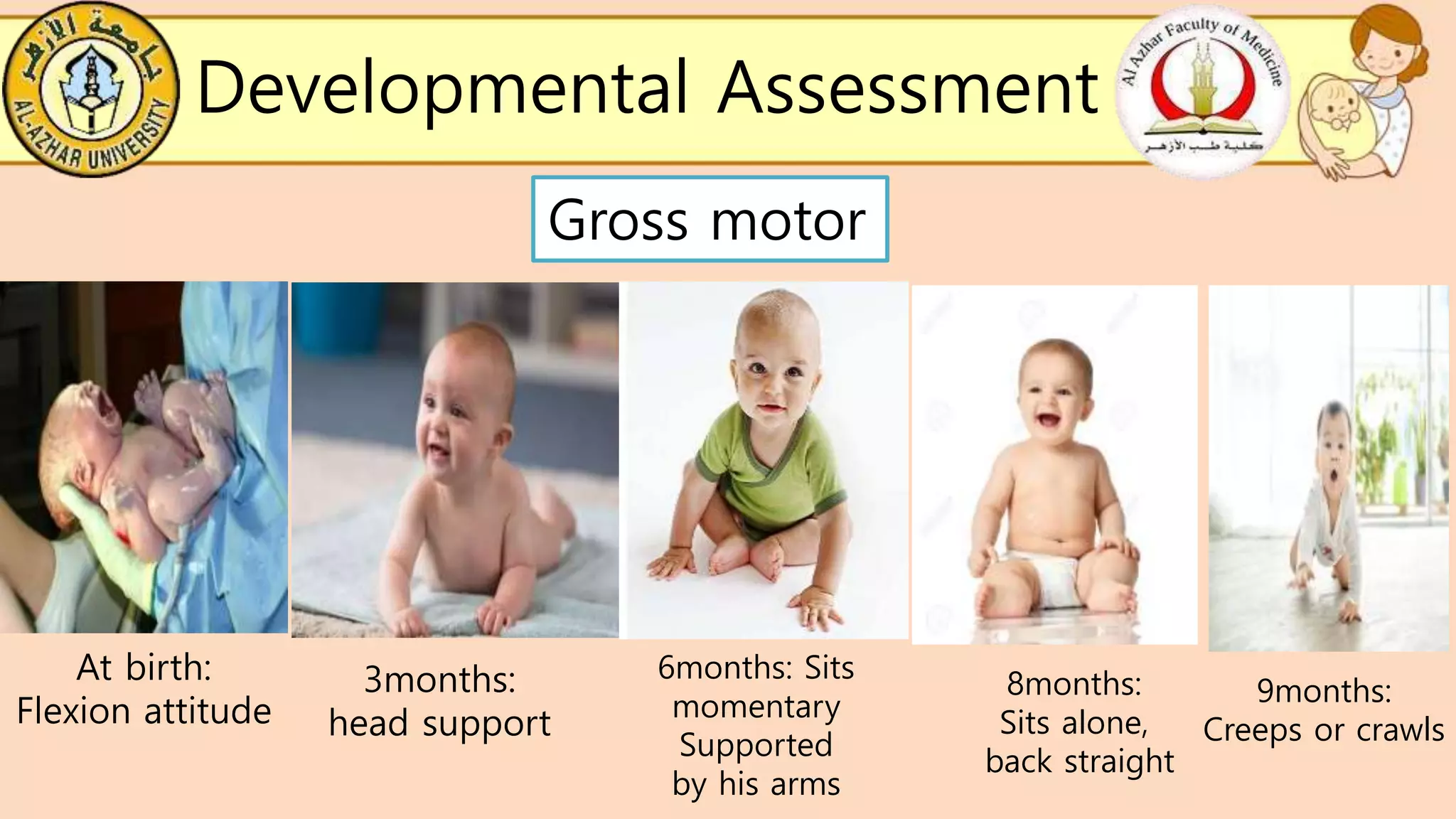 Global Developmental Delay (GDD) | PPTX